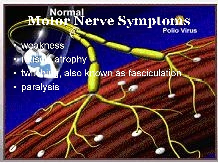 Nerve Damage and Neurodegeneration By Jennifer Joiner Cody