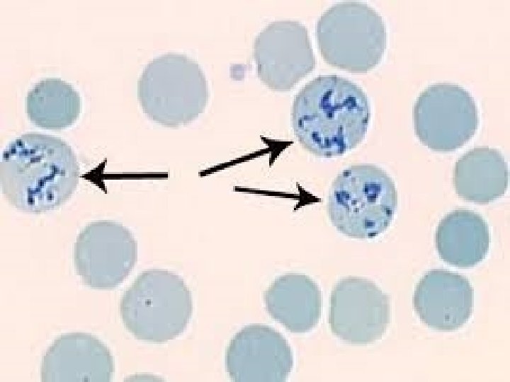 Practical Hematology Lab LAB 5 Reticulocyte Count Reticulocyte