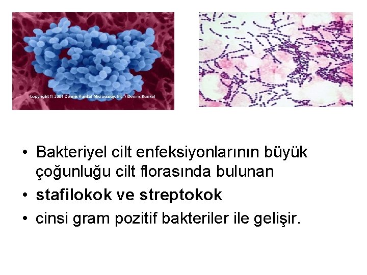 Cilt ve yumuak doku enfeksiyonlar Prof Dr Berna