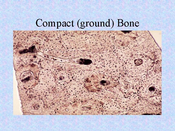 Connective Tissues What are we talking about Cartilage