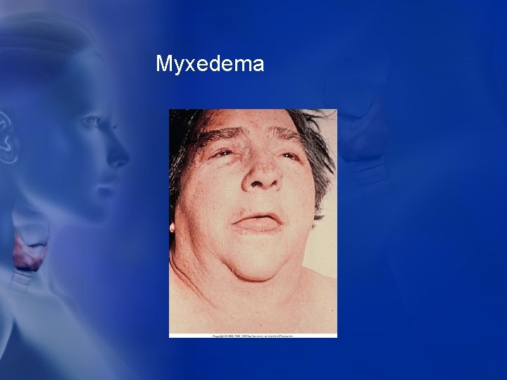 Chapter 66 Care of Patients with Problems of