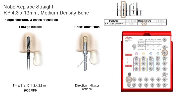 Study Club Name Nobel Replace Straight Drill Protocol