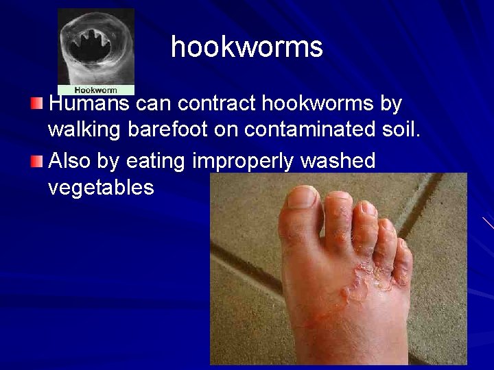 The Worms Phylum Platyhelminthes Phylum Nematoda Phylum Annelida