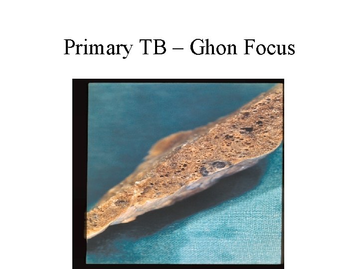 Respiratory Infections Dr Mulazim Hussain Bukhari Respiratory tract