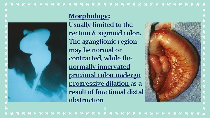 4 Small and Large Intestines Obstructive and vascular