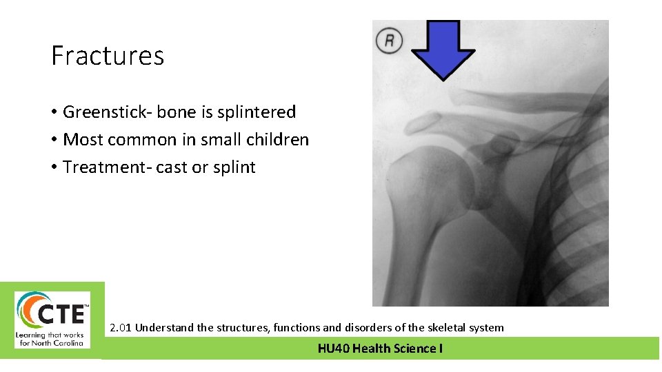 Skeletal System 2 00 Understand the bodys support
