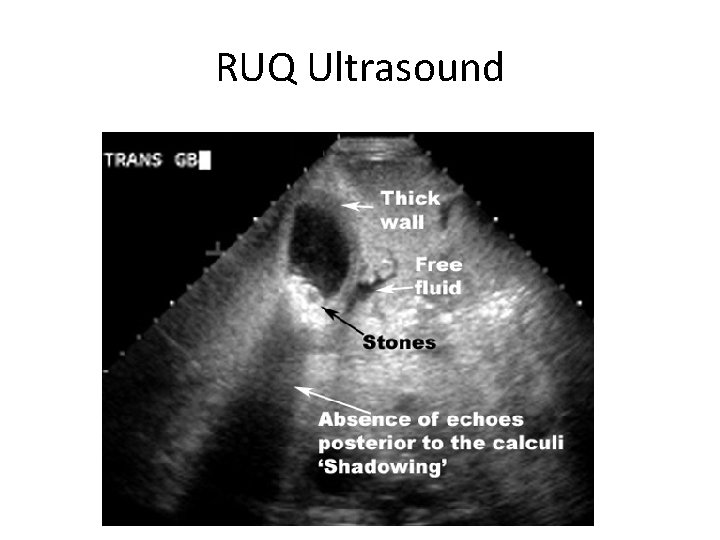 Abdominal Pain OUWB School Of Medicine Beaumont Health