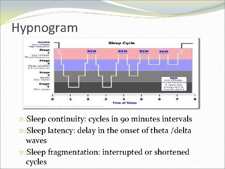 Sleeping Disorders Rebecca Sposato MS RN Normal Sleep