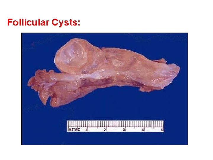 Chapter 4 Benign Conditions Of Specific Reproductive Organs