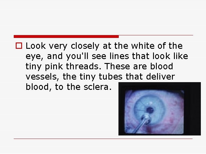 Anatomy of the Eye Sclera o The white