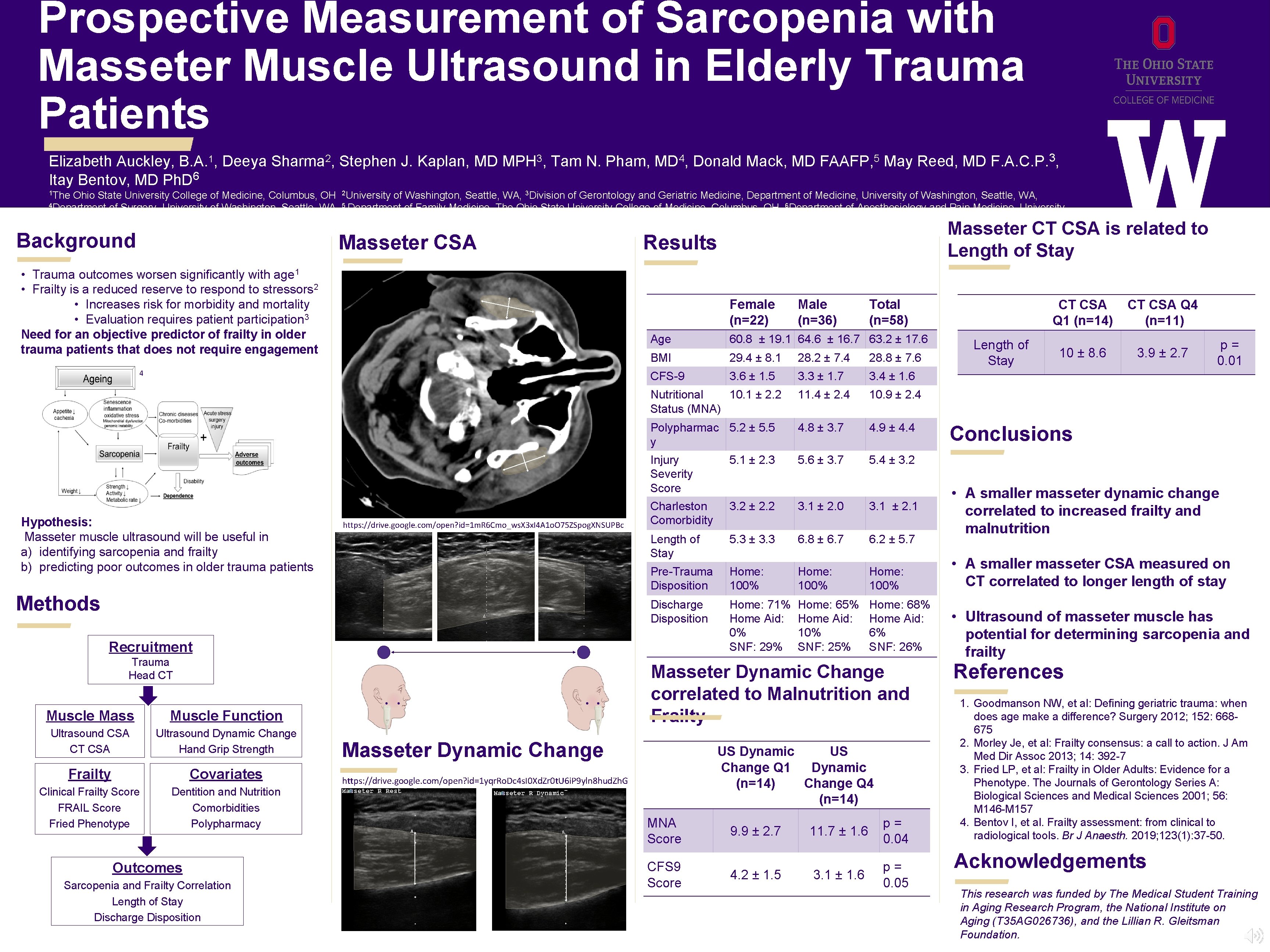 Prospective Measurement of Sarcopenia with Masseter Muscle Ultrasound