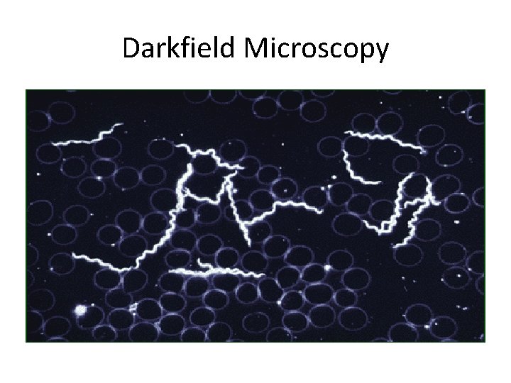 Main pathogenic bacteria of Spirochetaceae Genus Species Subspecies