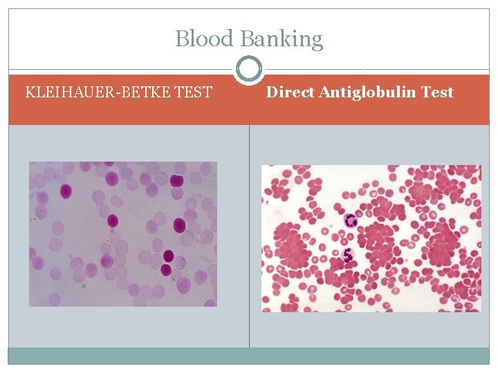 Clinical Laboratory Science A LOOK INTO THE VARIOUS