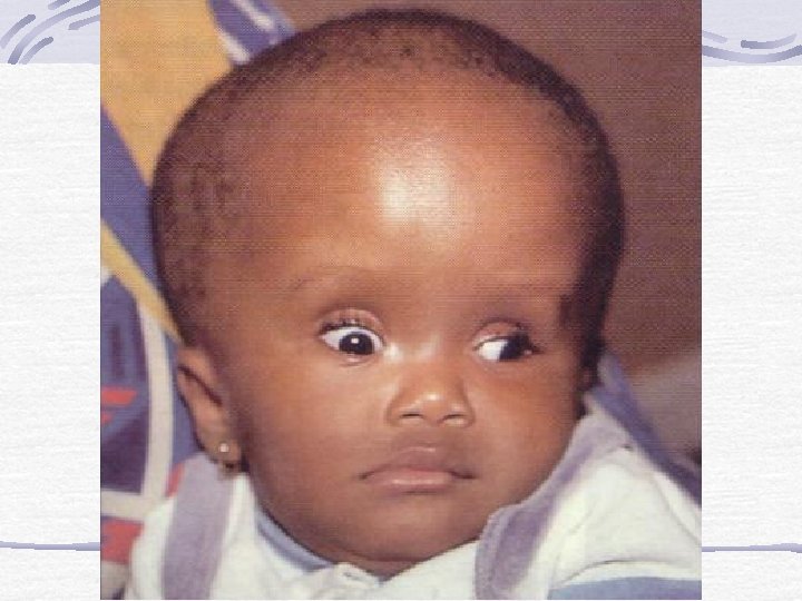 TUMEURS CEREBRALES ET MEDULLAIRES M MAZZUCA CHU de