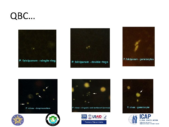 Module 1 Overview of Malaria 1 Learning Objectives