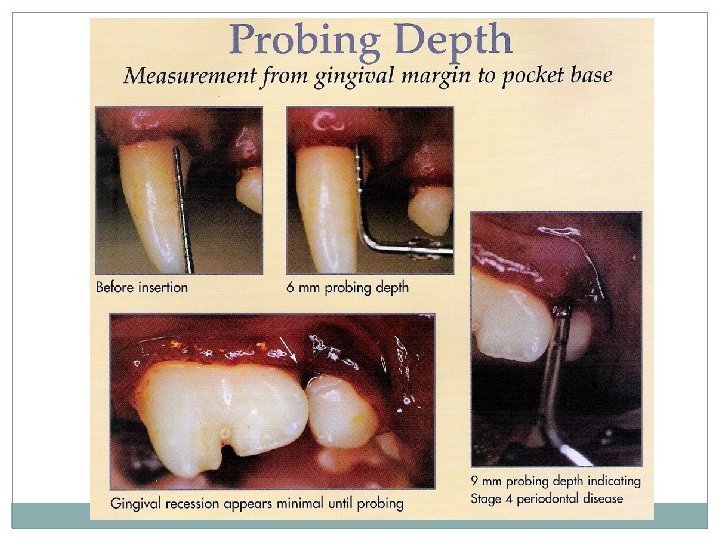 Normal Periodontium Remember which structures make up the