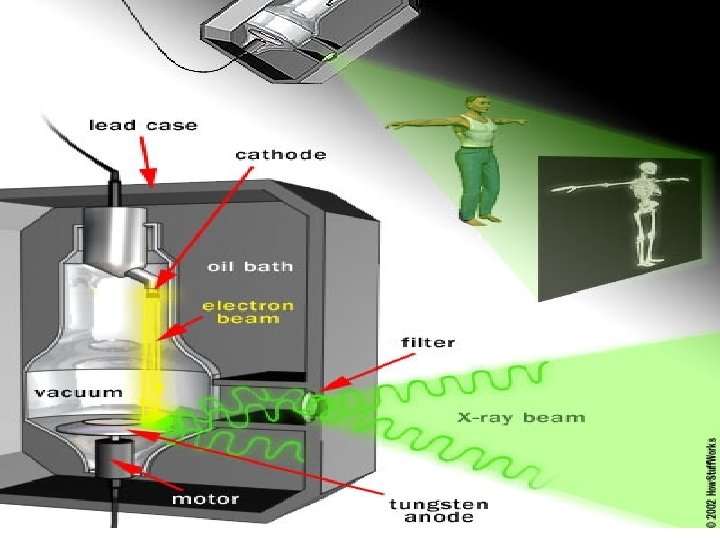 XRays The technology behind them The EM used
