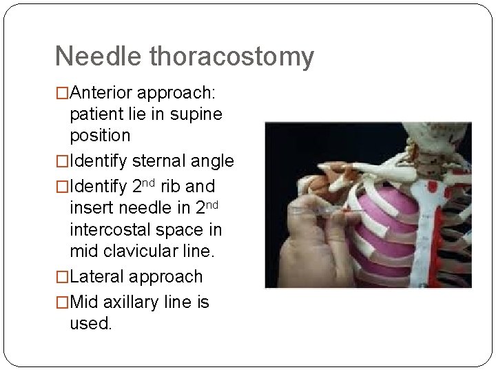 Clinical anatomy of thoracic cage and cavity1 Dr