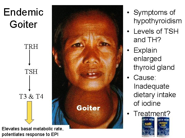 Wednesday 17 September Finish Ch 11 Endocrine System