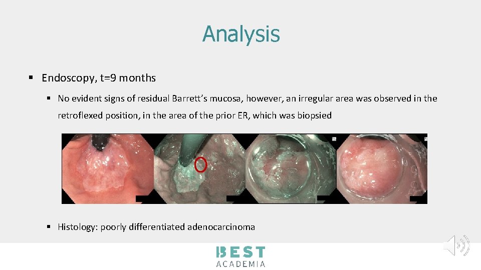 Challenging cases from the Dutch Barrett Expert Center