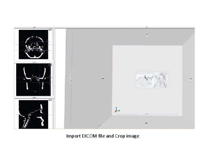 Cone Beam Computed Tomography CBCT Dr Hussein Ahmed