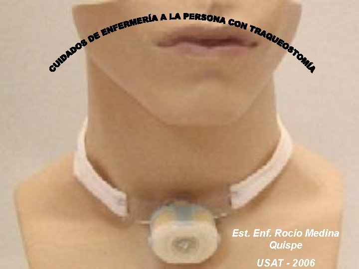 Est Enf Roco Medina Quispe USAT 2006 DEFINICON