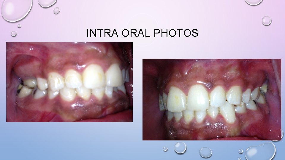 PERIODONTAL CASE STUDY PROJECT YOLANDA COLON PATIENT PROFILE