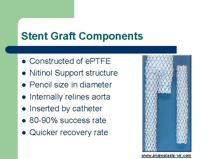 Abdominal Aortic Aneurysm Case Study By Lisa Erwert