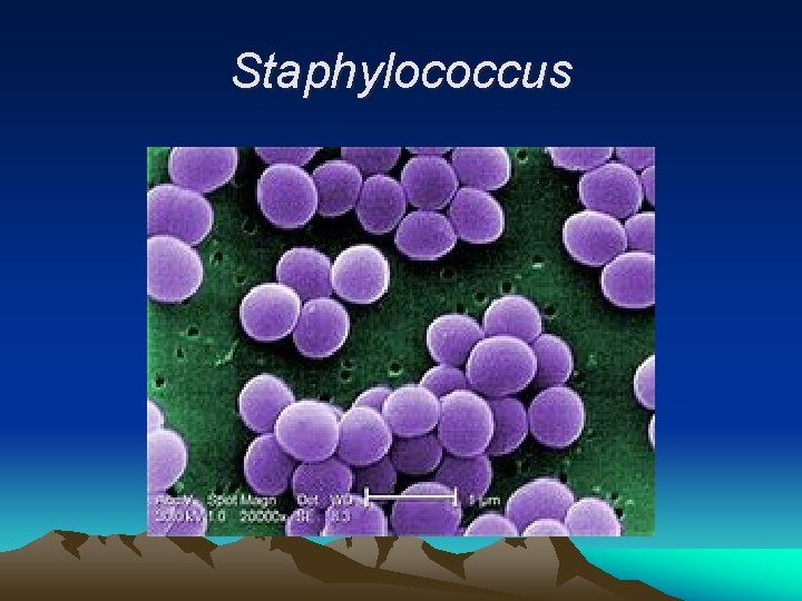 Bacteria Viruses Fungi and Protists Biology Chapters 19