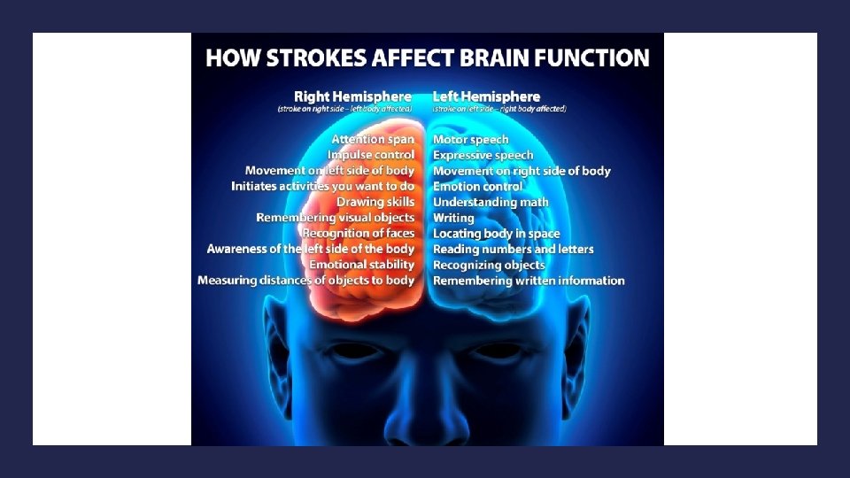 NEUROPROSTHETICS THE FUTURE OF STROKE REHABILITATION FOR MOTOR