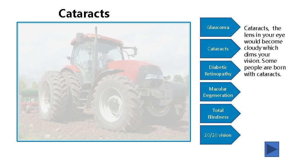 Eye Condition Simulator Double click on the options