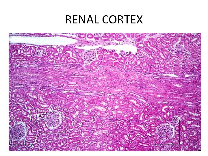 THE KIDNEY PATHOPHYSIOLOGY OF FILTRATION ABNORMALITIES BY DR
