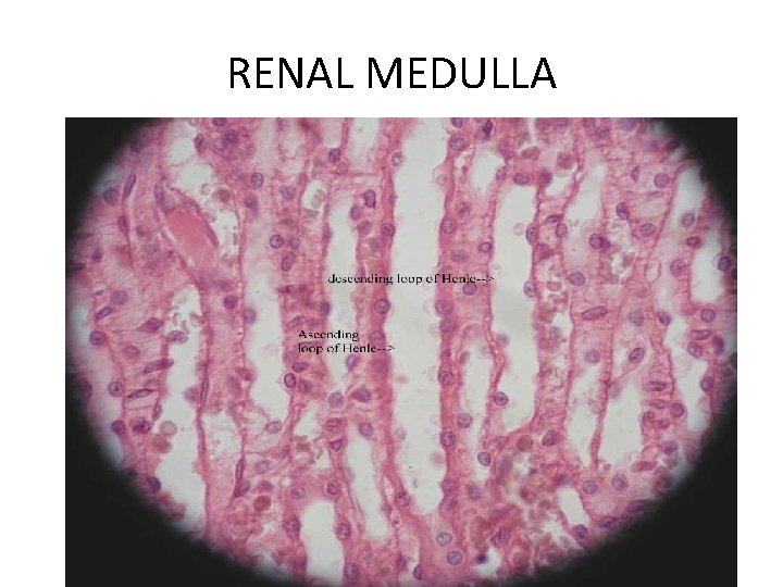 THE KIDNEY PATHOPHYSIOLOGY OF FILTRATION ABNORMALITIES BY DR