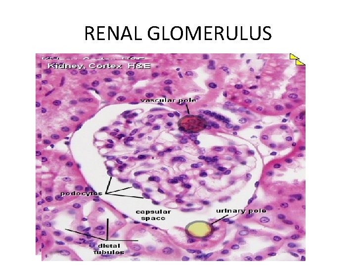 THE KIDNEY PATHOPHYSIOLOGY OF FILTRATION ABNORMALITIES BY DR