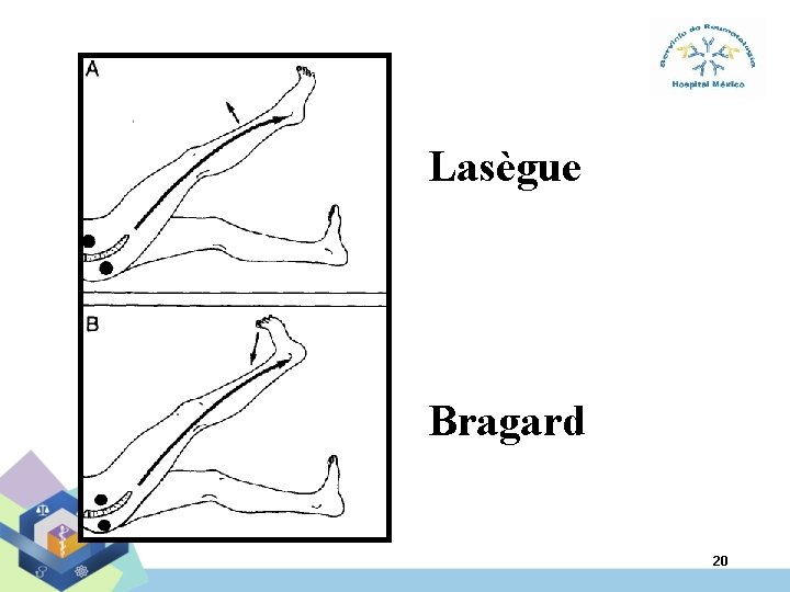 LUMBALGIA Generalidades Dr Pablo Monge Zeledn 2 Lumbalgia
