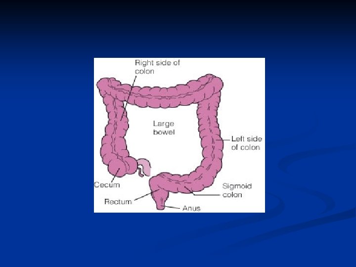 Diseases of Large Bowel Diverticulosis of the Colon