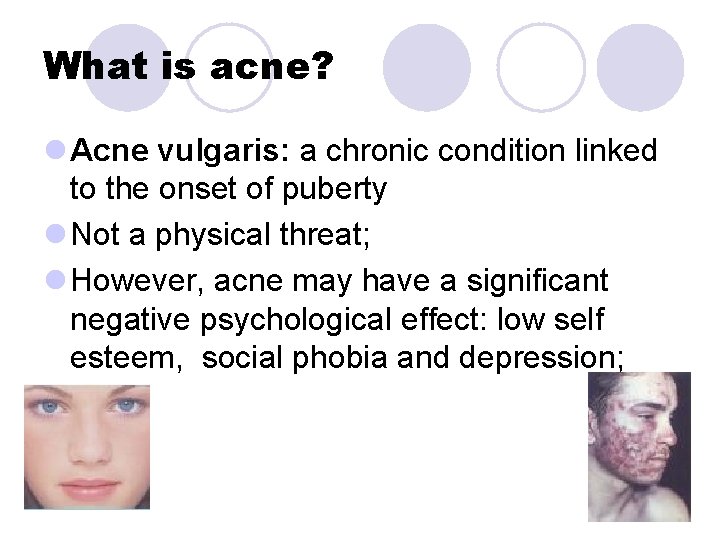 Treatment of Acne What is acne l Acne