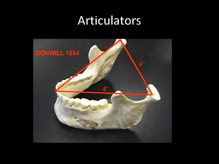 Fundamentals Of Occlusion The TemporoMandibular Joints Why Is