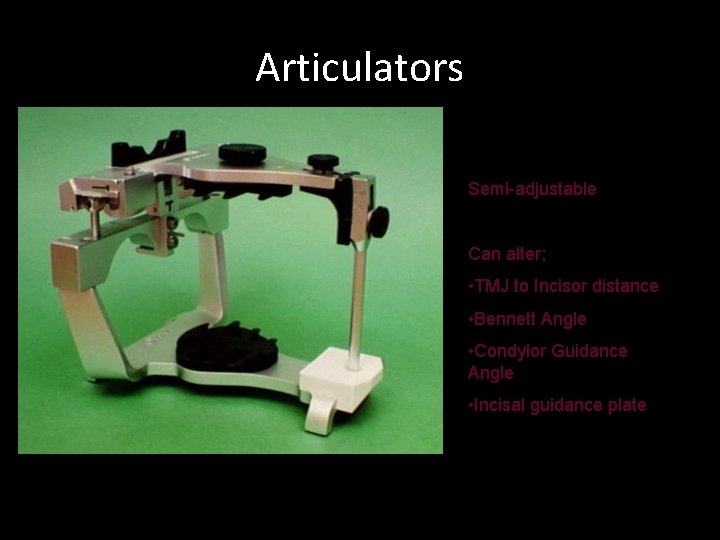 Fundamentals Of Occlusion The TemporoMandibular Joints Why Is