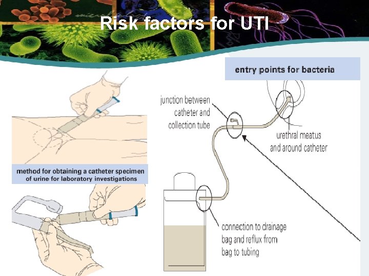 Microbes Causing Urinary Tract Infection LECTURE BLOCK 15