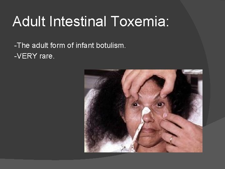 Botulism A rare and sometimes fatal paralytic illness