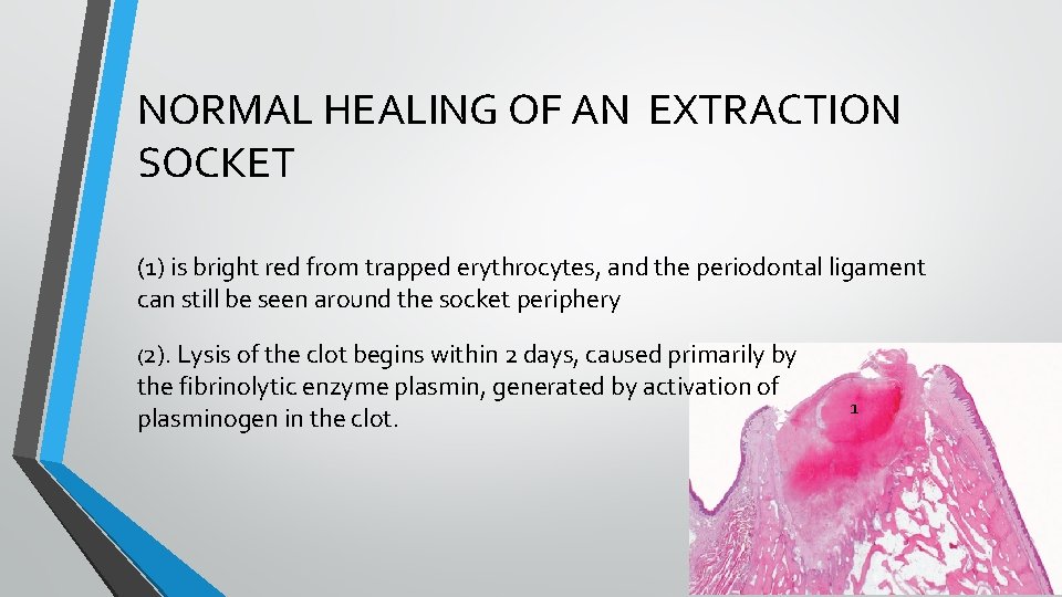 Infections of the jaws Prepared by Supervised by