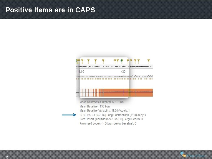 Pericalm Checklist Peri CALM Checklist Emily Hamilton MDCM