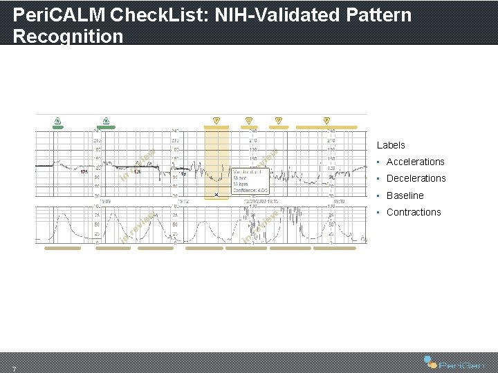 Pericalm Checklist Peri CALM Checklist Emily Hamilton MDCM