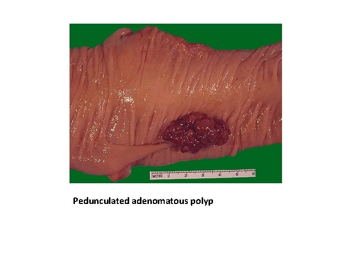 GI lab 2 Small and large intestines Normal