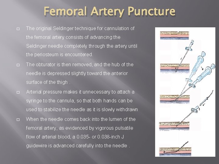 BASICS OF CARDIAC VENTRICULOGRAPHY Introduction Indications ...