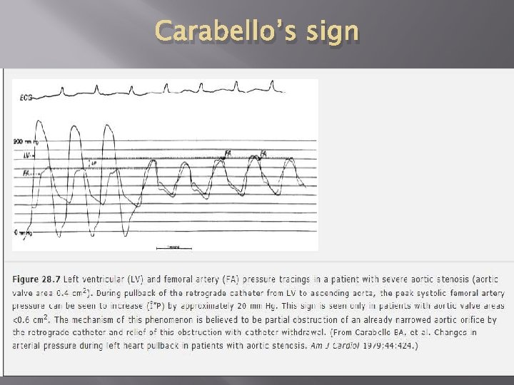 BASICS OF CARDIAC VENTRICULOGRAPHY Introduction Indications ...