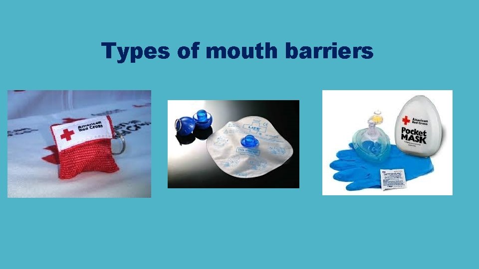 Basic CPR skills By Sonia Sanchez Heart disease