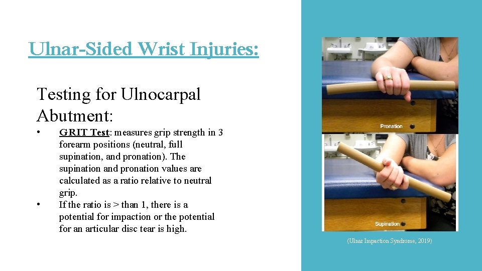 UlnarSided Wrist Pain in the Athlete Sarah A