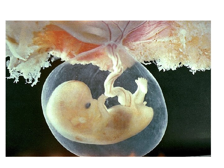 Foetal Membranes Amnion Definition The thin transparent inner